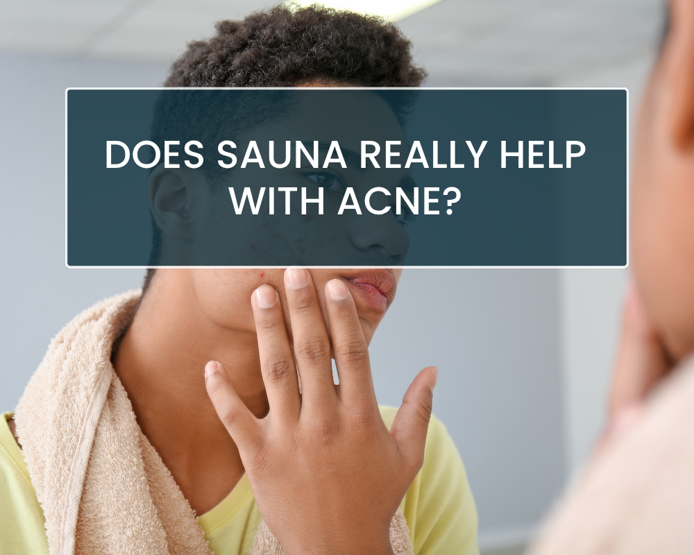 Can Sauna Use Improve Acne? Science-Backed Facts